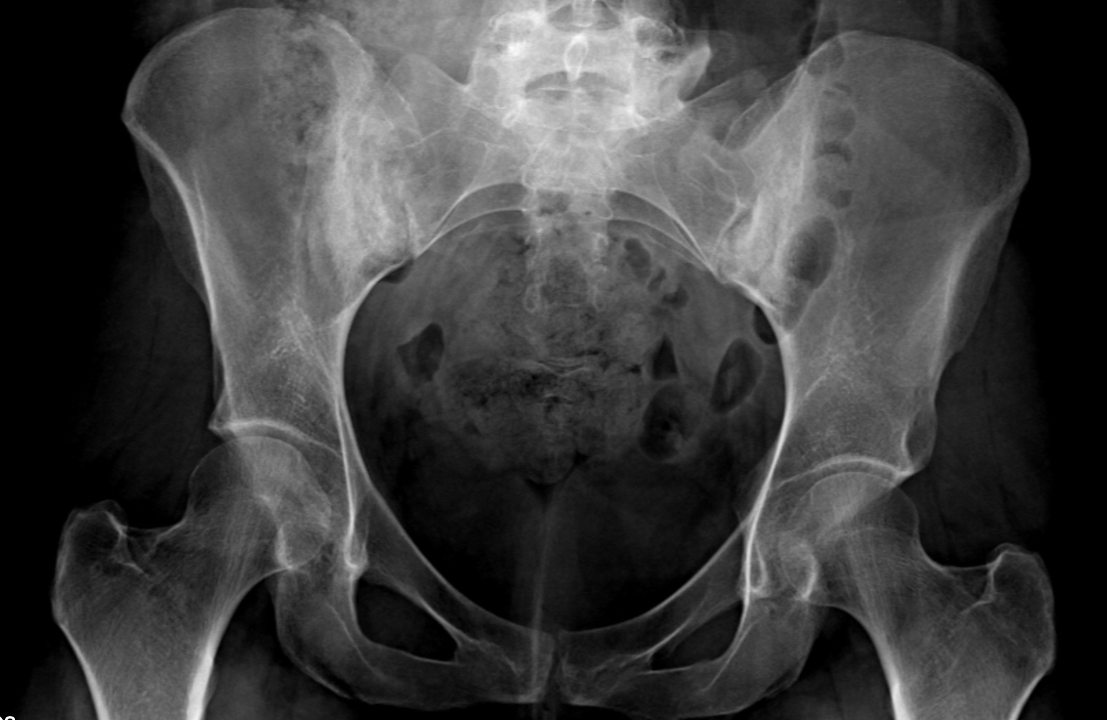 Radiographic Abnormality at Dorla Walker blog