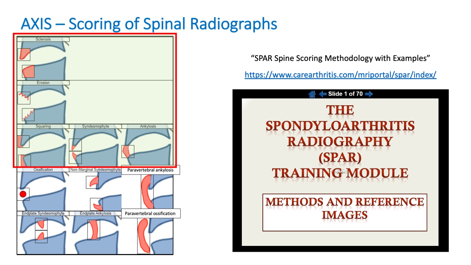 PSA Additions to SPAR Spine scoring